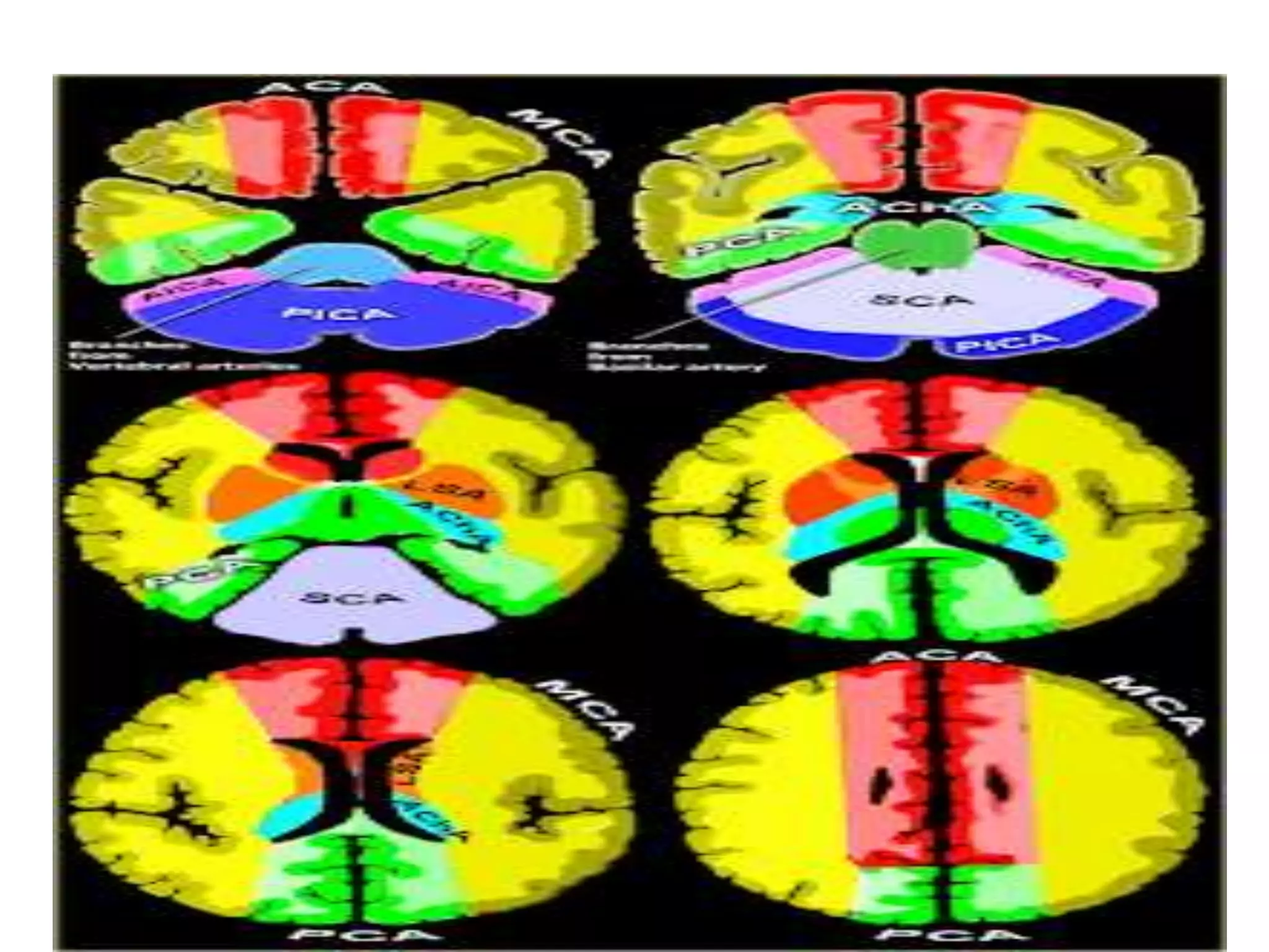 Imaging in neurology - normal MR Angio and Venography | PPTX