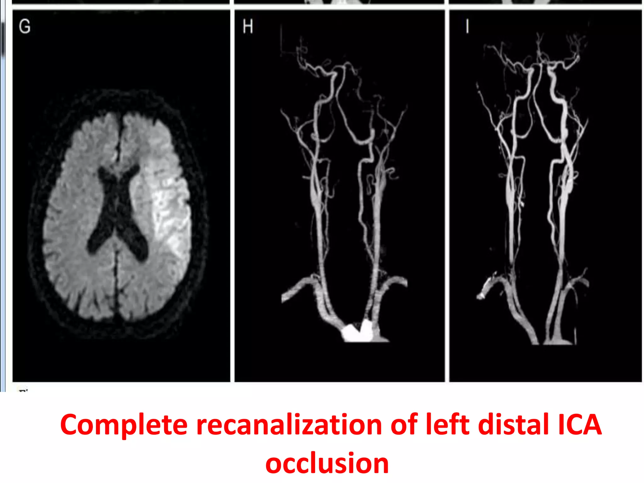 Imaging in neurology - normal MR Angio and Venography | PPTX
