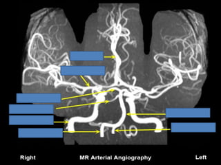 Imaging in neurology - normal MR Angio and Venography | PPTX