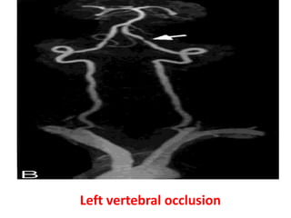 Imaging in neurology - normal MR Angio and Venography | PPTX