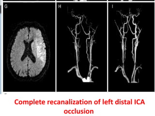 Imaging in neurology - normal MR Angio and Venography | PPTX