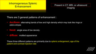 Imaging ofsplenic diseases [Autosaved].pptx