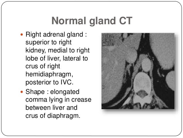 Imaging Of Adrenal Masses