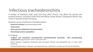 Imaging of Airway Diseases | PPTX