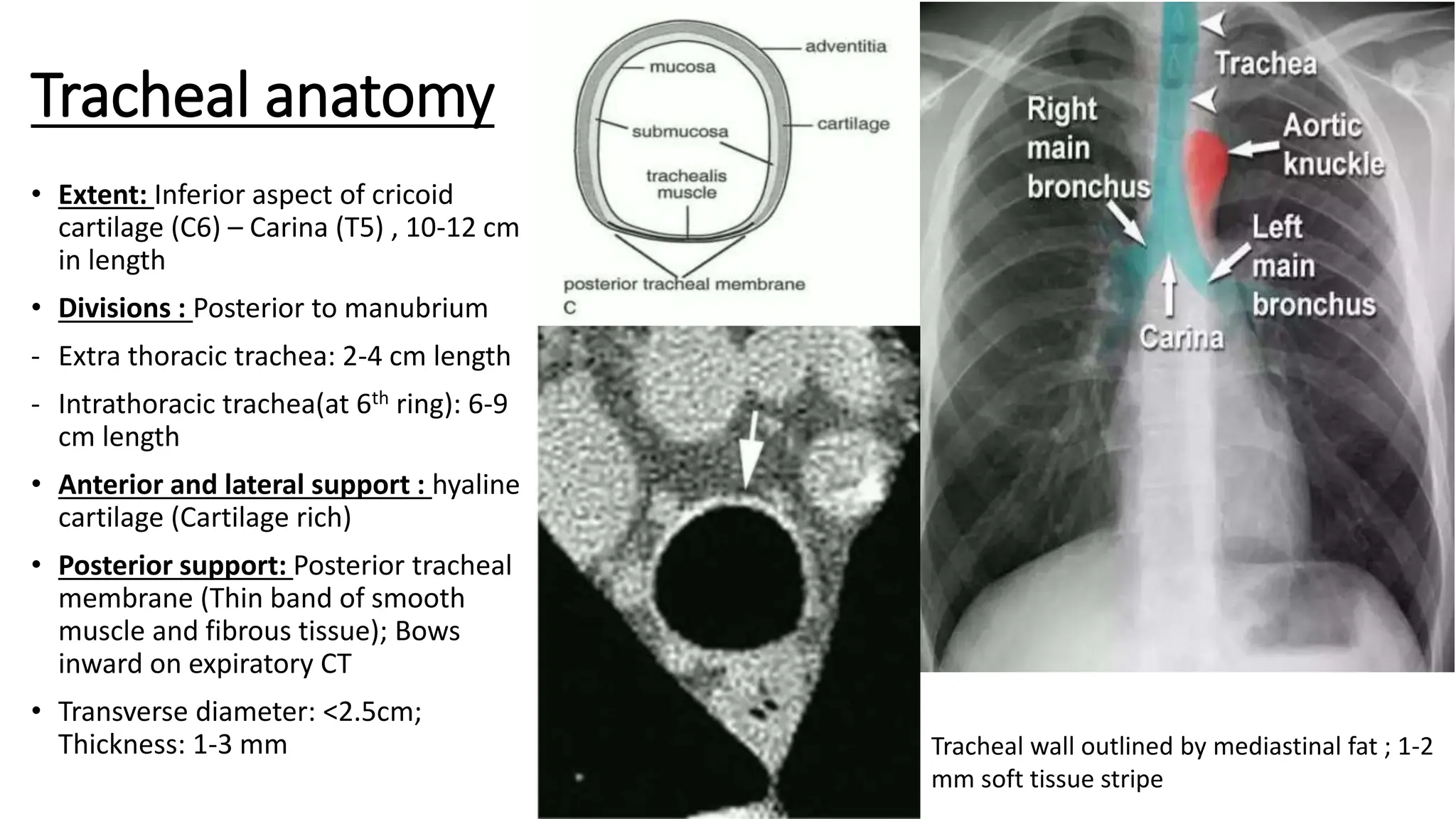 Imaging of large and small airway diseases.pptx