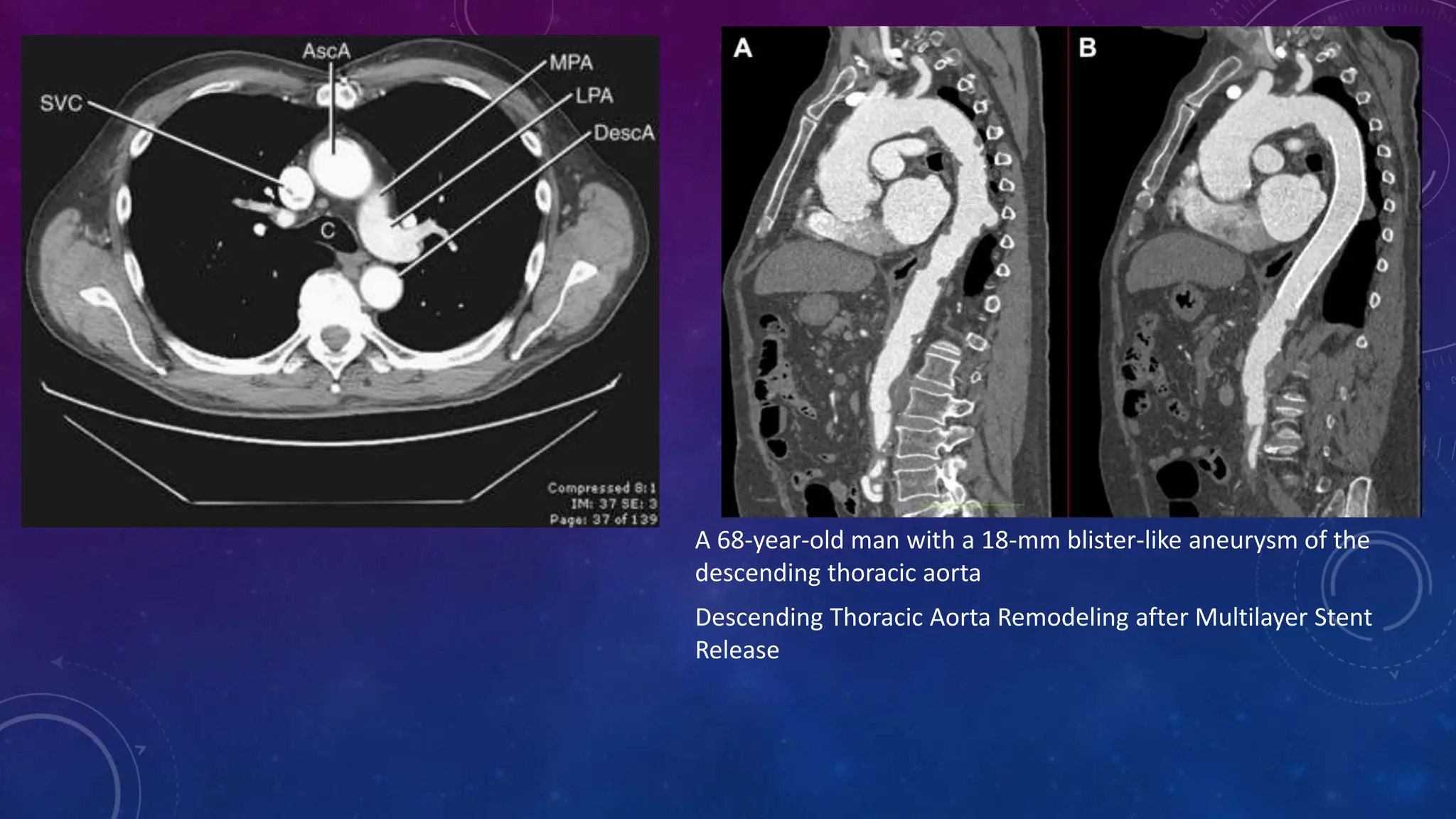 imaging of aorta(branches of thorax) (1).pptx