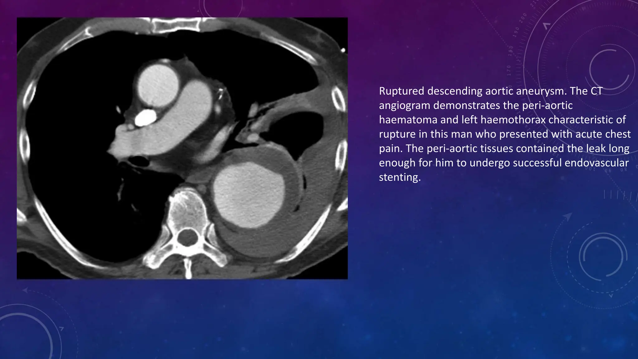 imaging of aorta(branches of thorax) (1).pptx