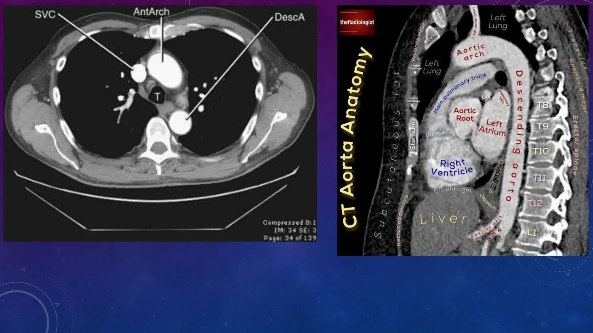 imaging of aorta(branches of thorax) (1).pptx