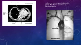 imaging of aorta(branches of thorax) (1).pptx