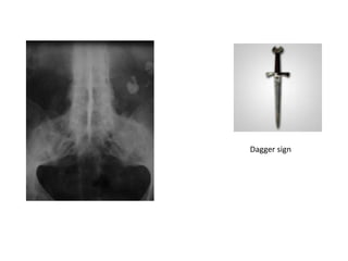 Imaging of arthritis.pptx
