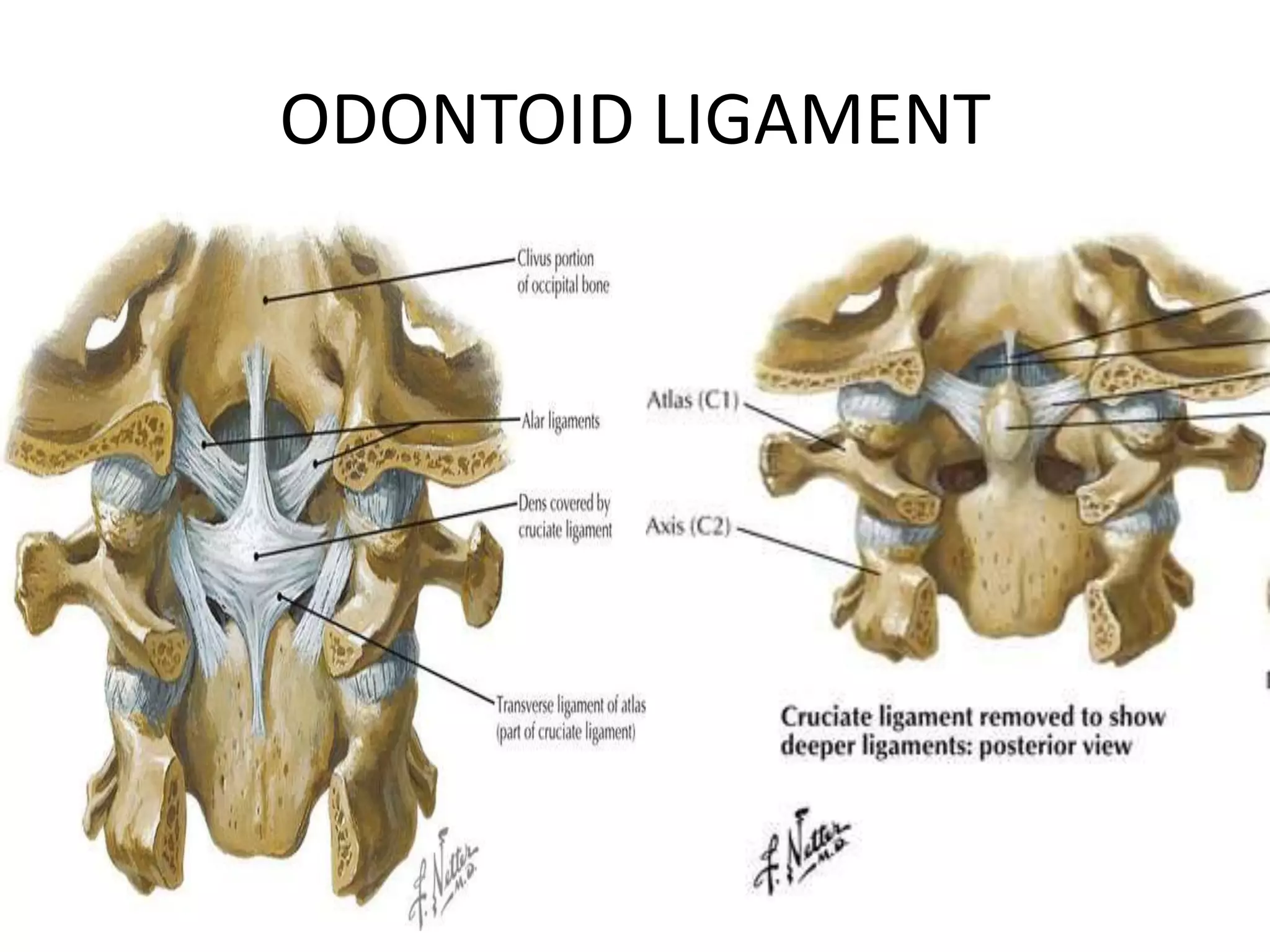 Imaging of atlanto occipital and atlantoaxial traumatic injuries | PPTX
