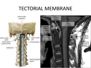 Tectorial Membrane Spine