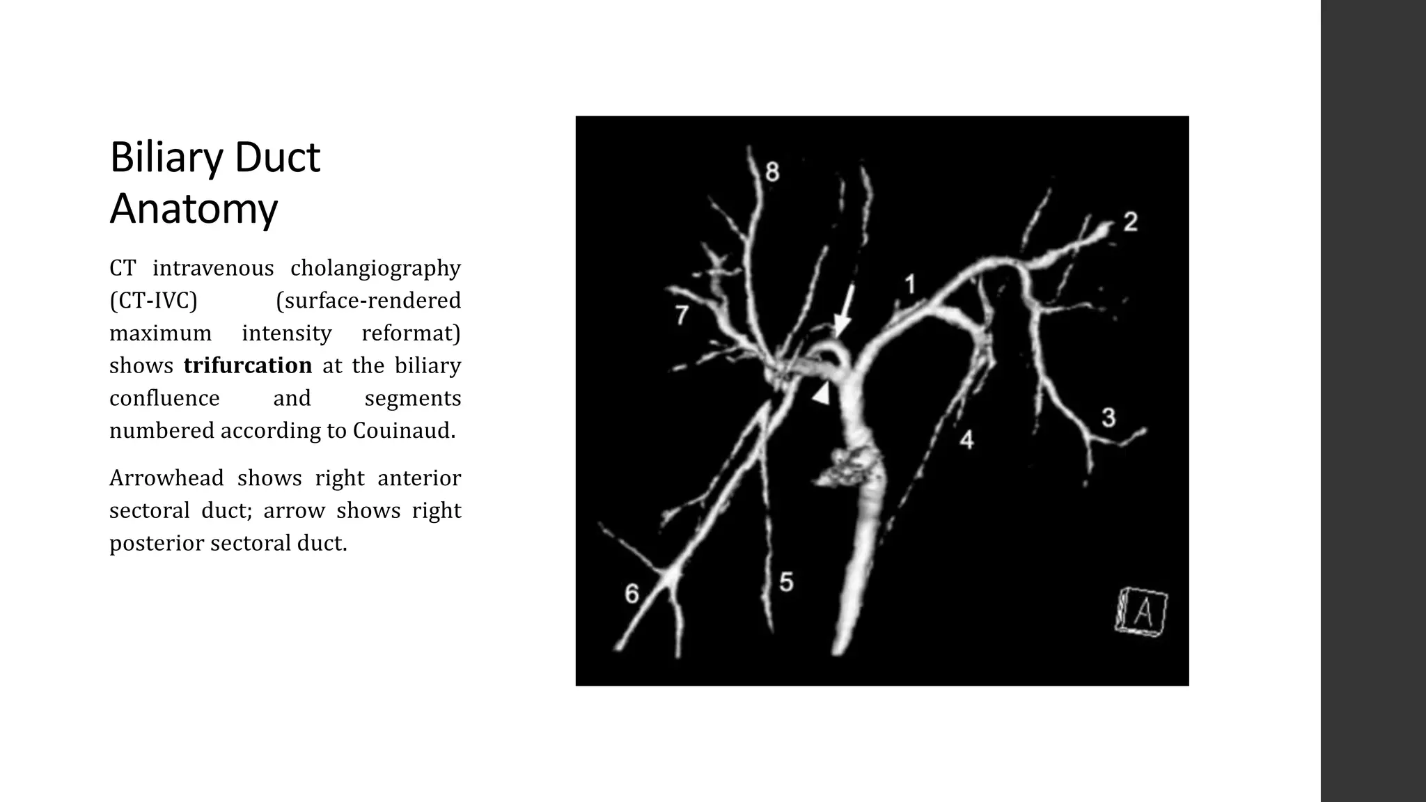 Imaging of the Biliary System and its Disorders | PPTX