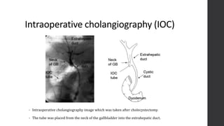 Imaging of the Biliary System and its Disorders | PPTX