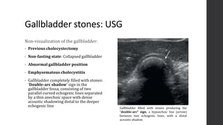 Imaging of the Biliary System and its Disorders | PPTX