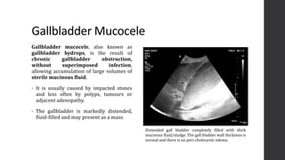 Imaging of the Biliary System and its Disorders | PPTX