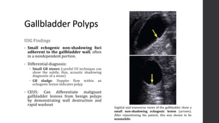 Imaging of the Biliary System and its Disorders | PPTX