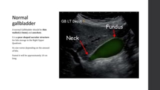 Imaging of the Biliary System and its Disorders | PPTX