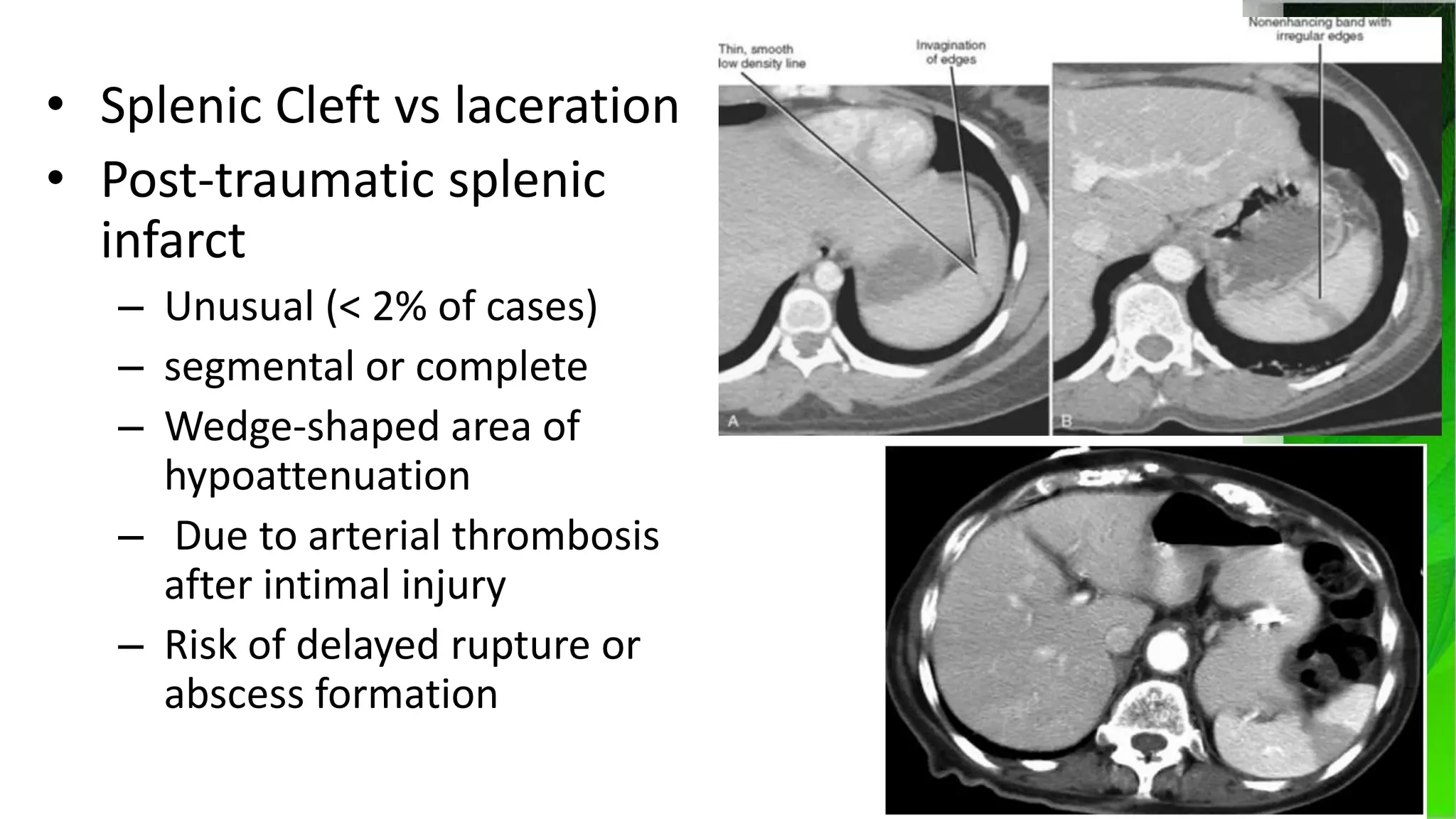 Imaging of blunt abdominal trauma.pptx