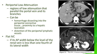Imaging of blunt abdominal trauma.pptx