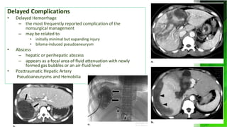 Imaging of blunt abdominal trauma.pptx