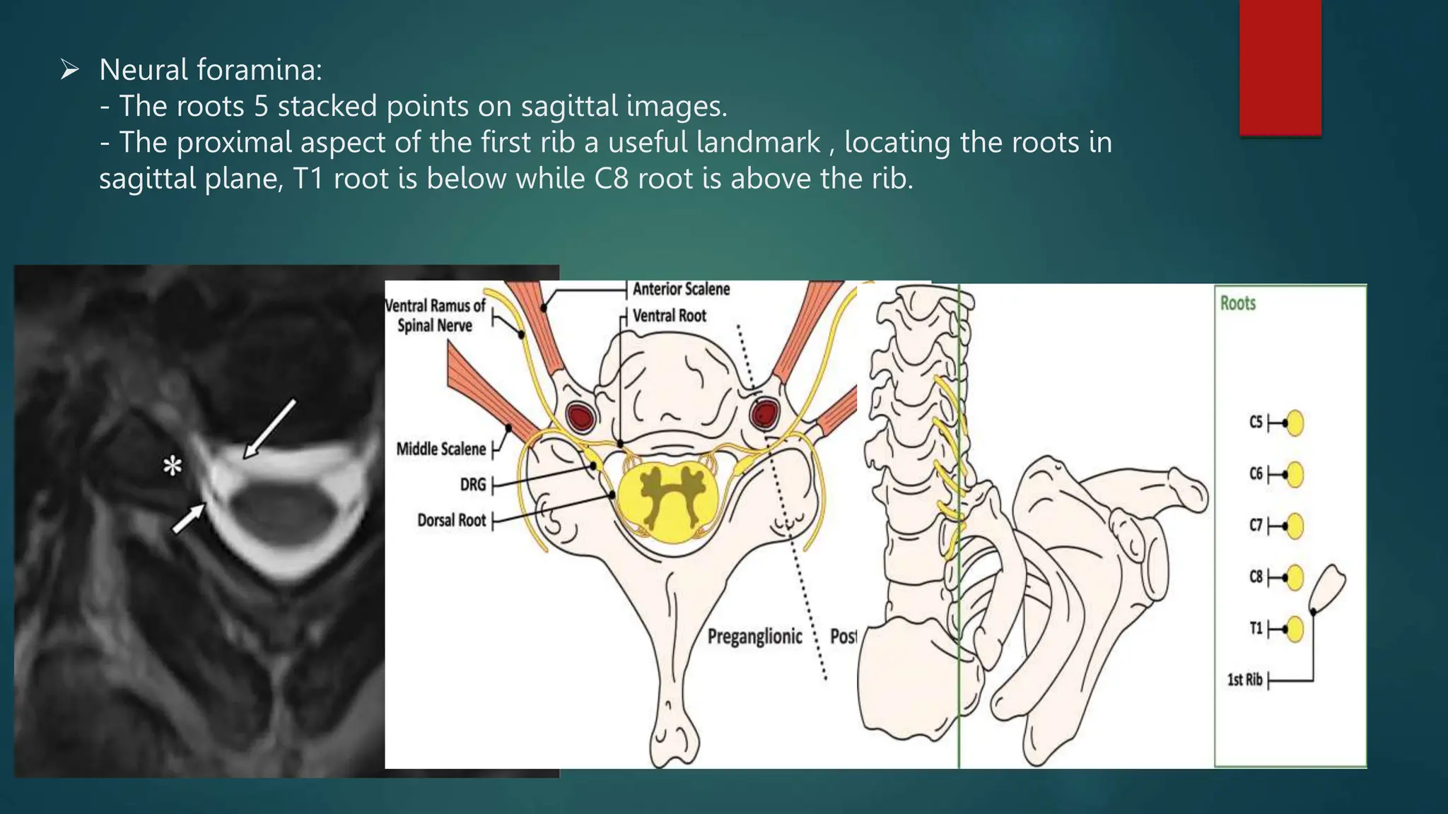 Imaging of brachial plexus.Radiology pptx | PPTX