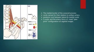 Imaging of brachial plexus.Radiology pptx | PPTX