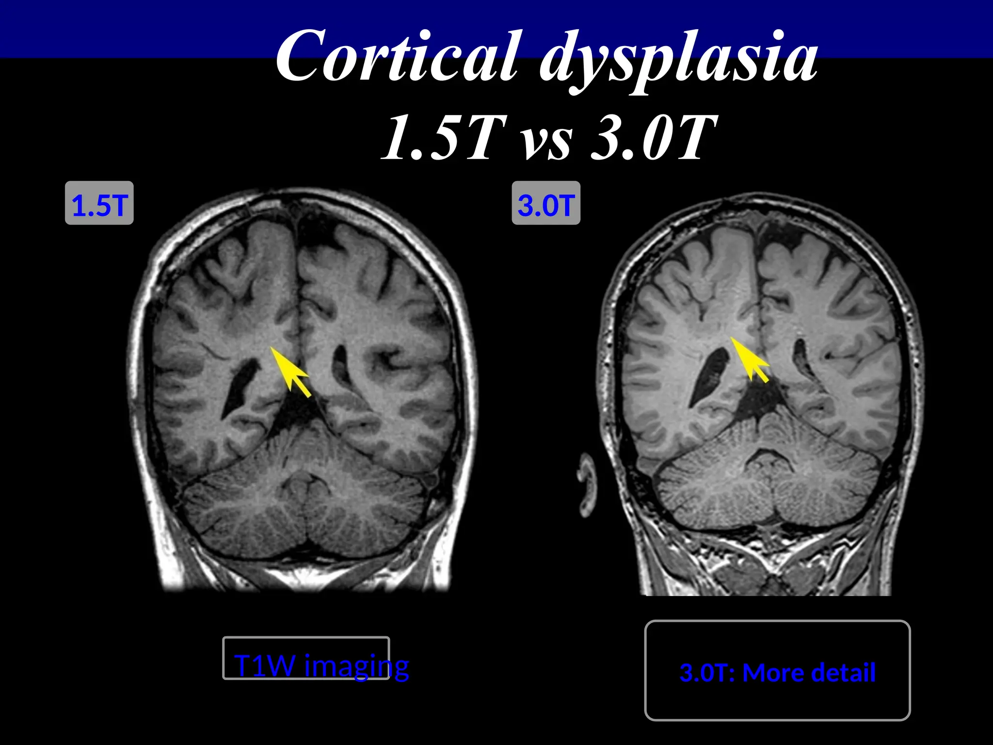 IMAGING OF CENTRAL NERVOUS SYSTEM IMS STUDENTS 19.12.2014.ppt
