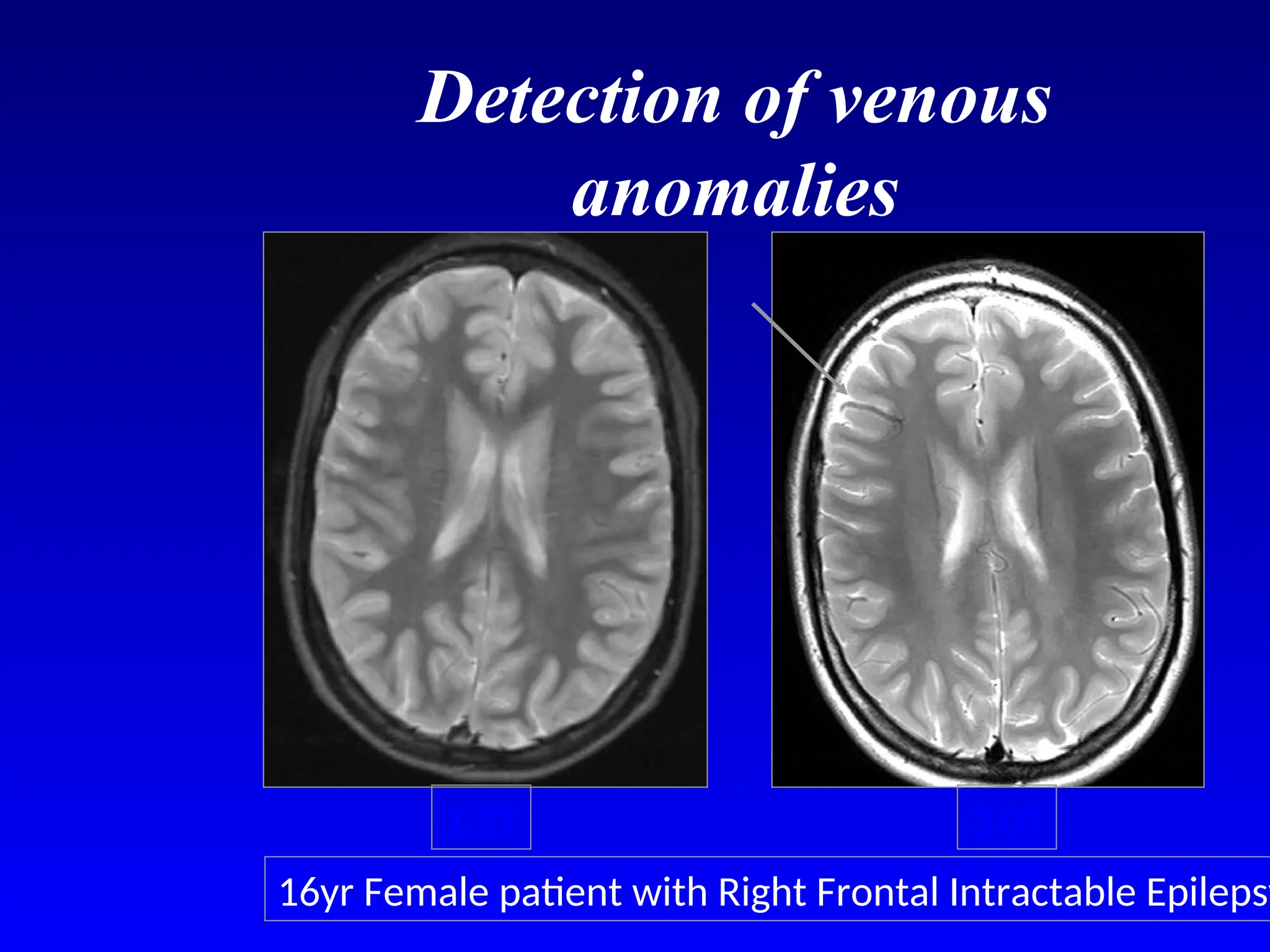 IMAGING OF CENTRAL NERVOUS SYSTEM IMS STUDENTS 19.12.2014.ppt