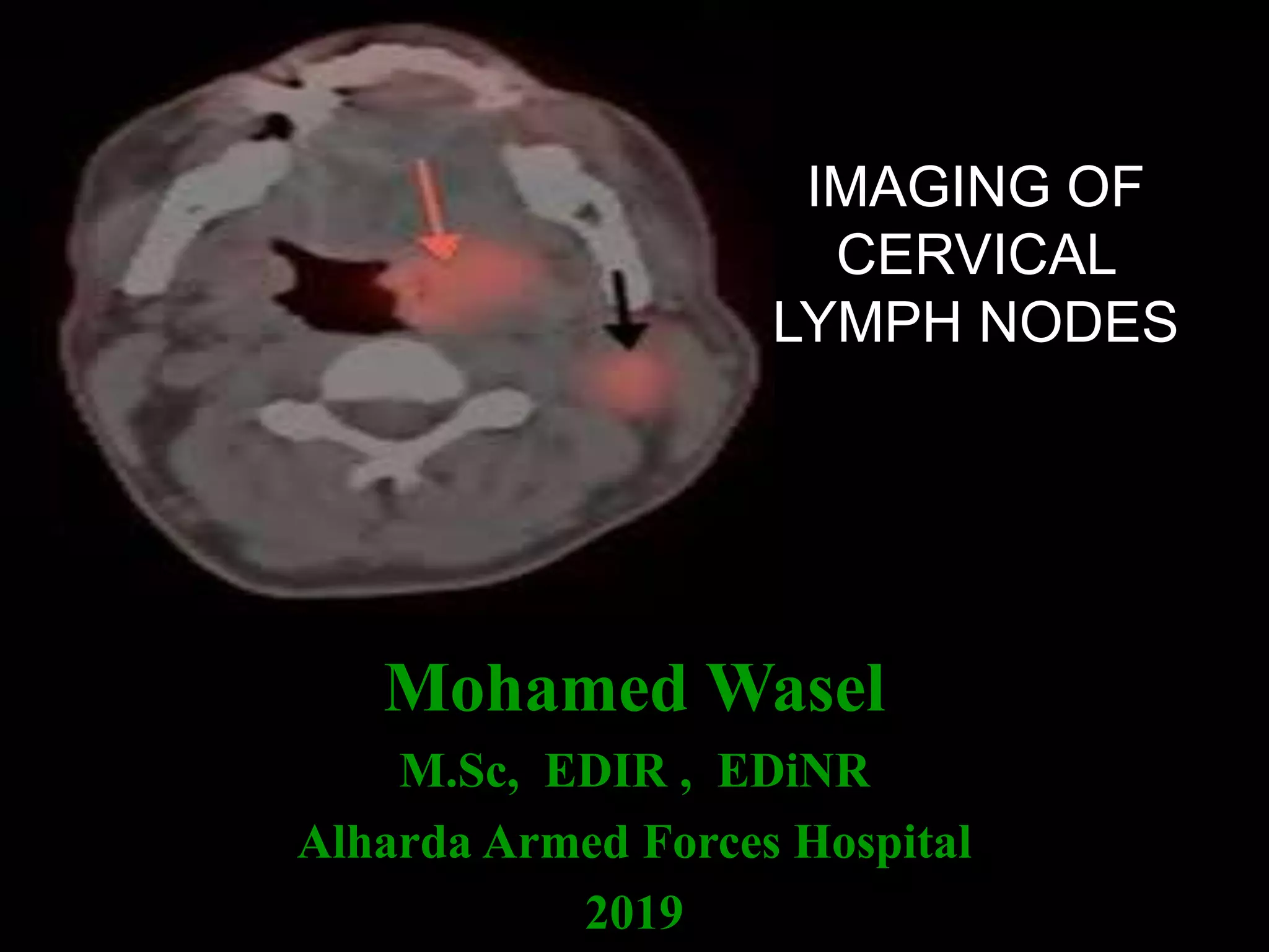 Imaging of cervical lymph nodes | PPTX