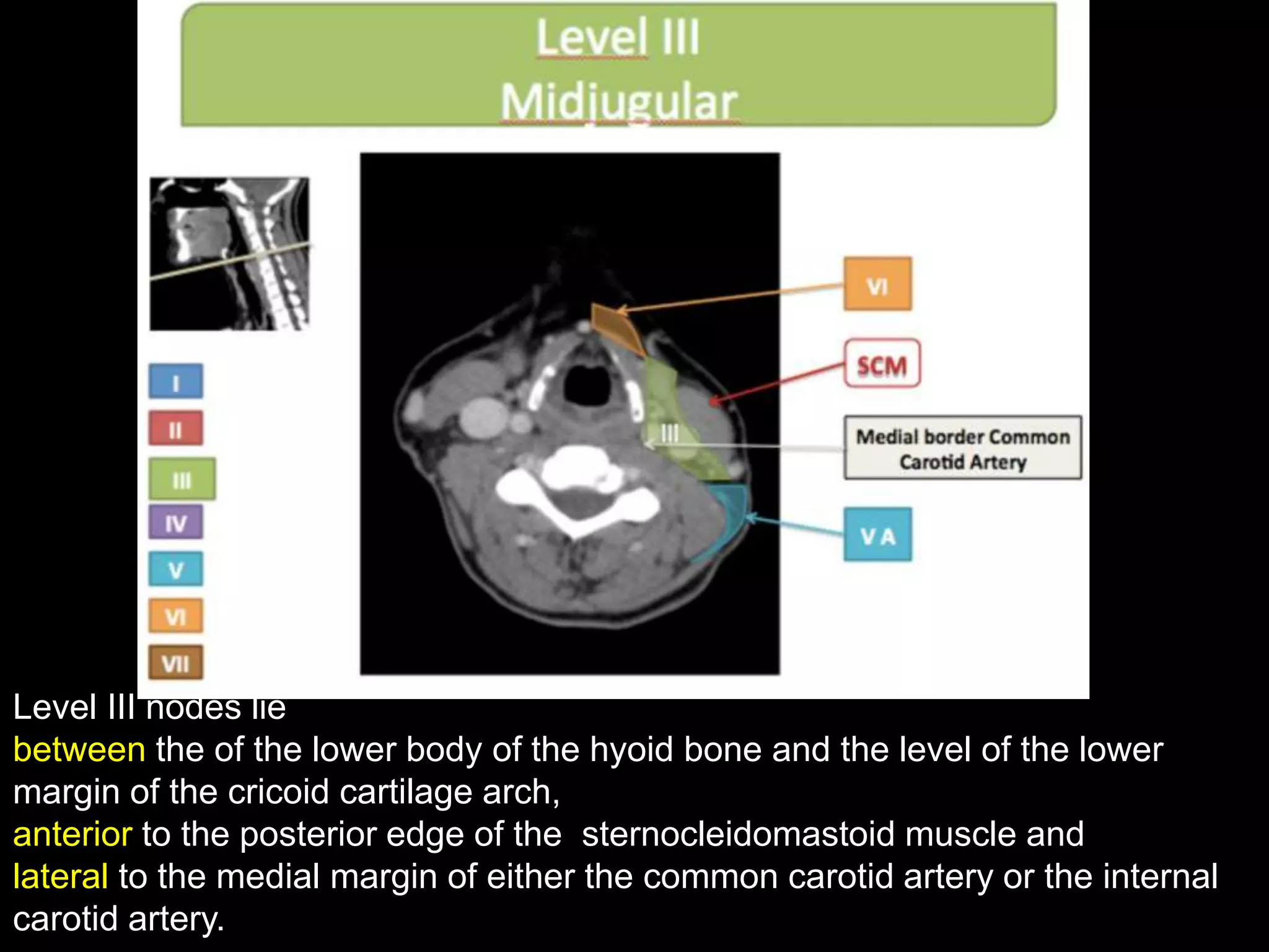 Imaging of cervical lymph nodes | PPTX