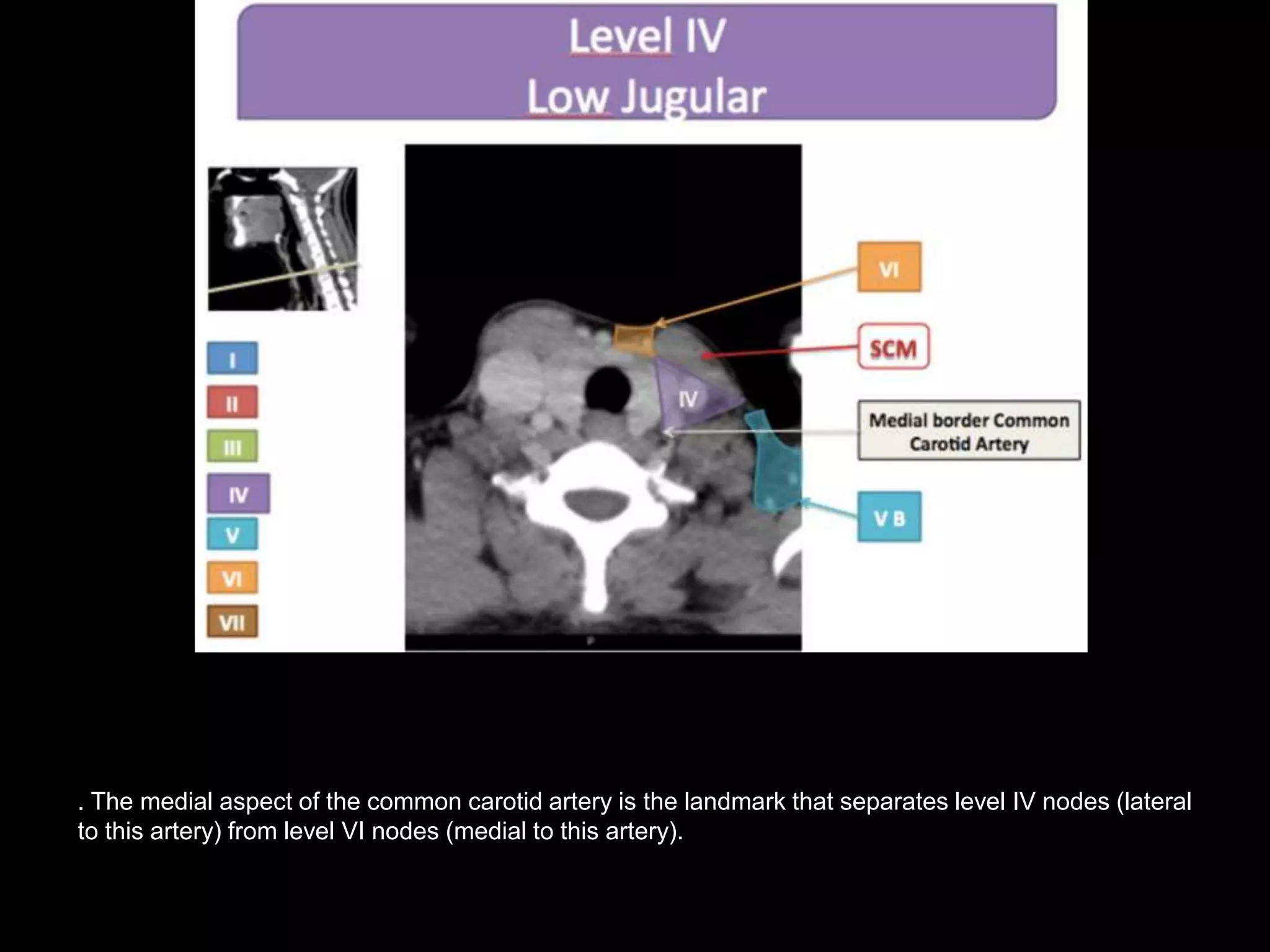 Imaging of cervical lymph nodes | PPTX