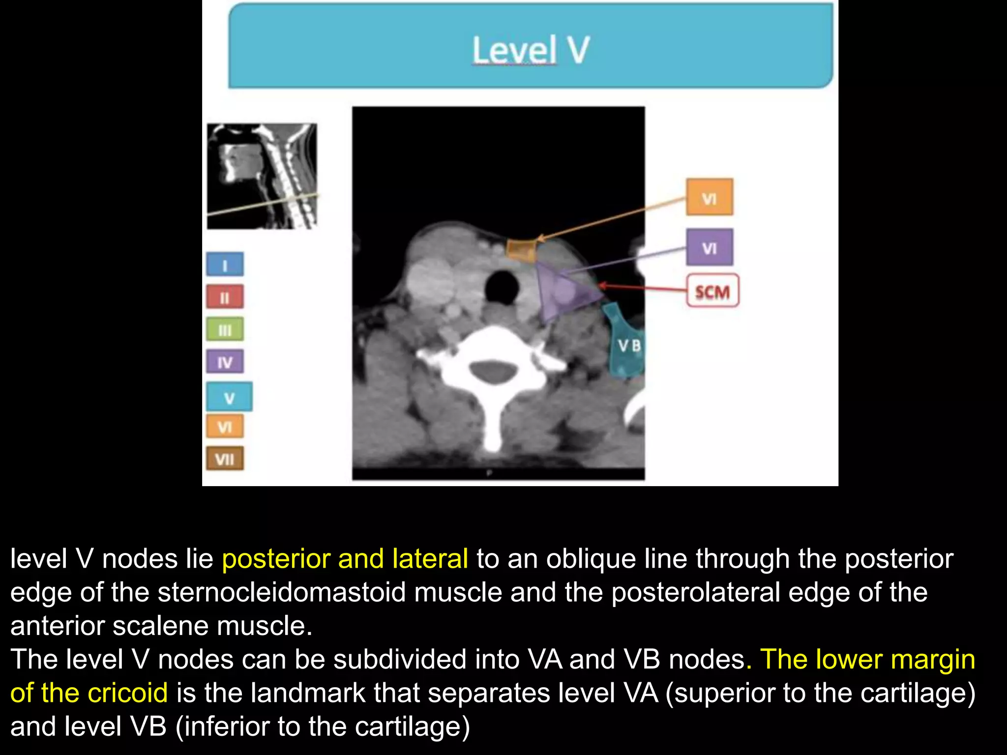 Imaging of cervical lymph nodes | PPTX
