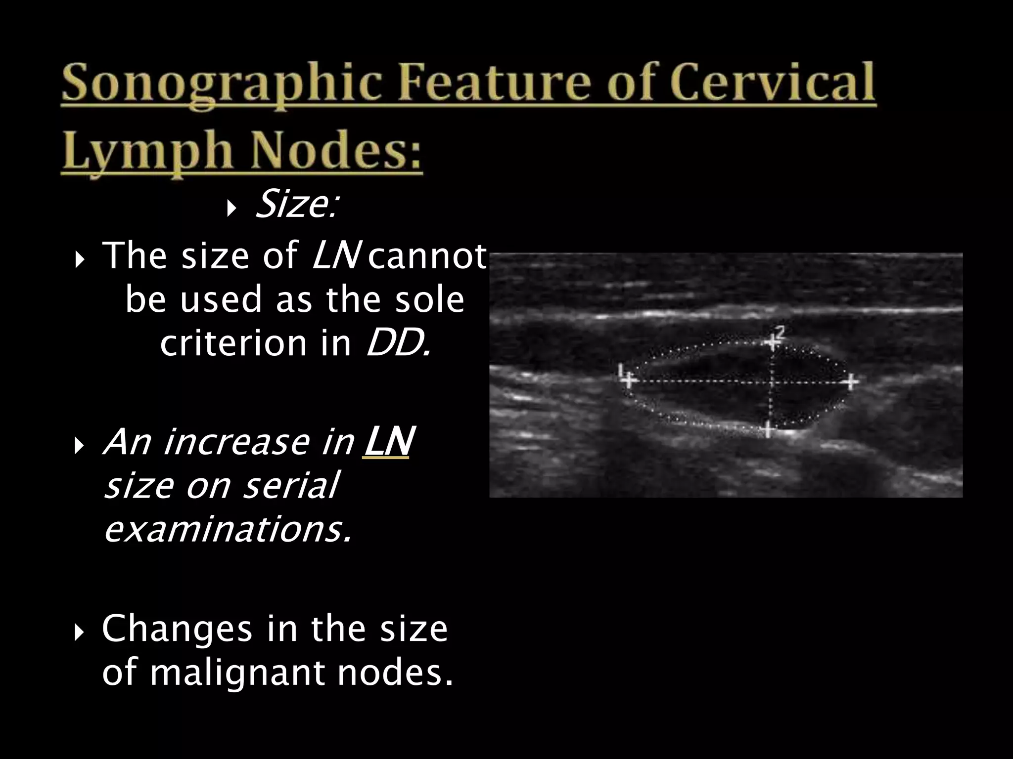 Imaging of cervical lymph nodes | PPTX