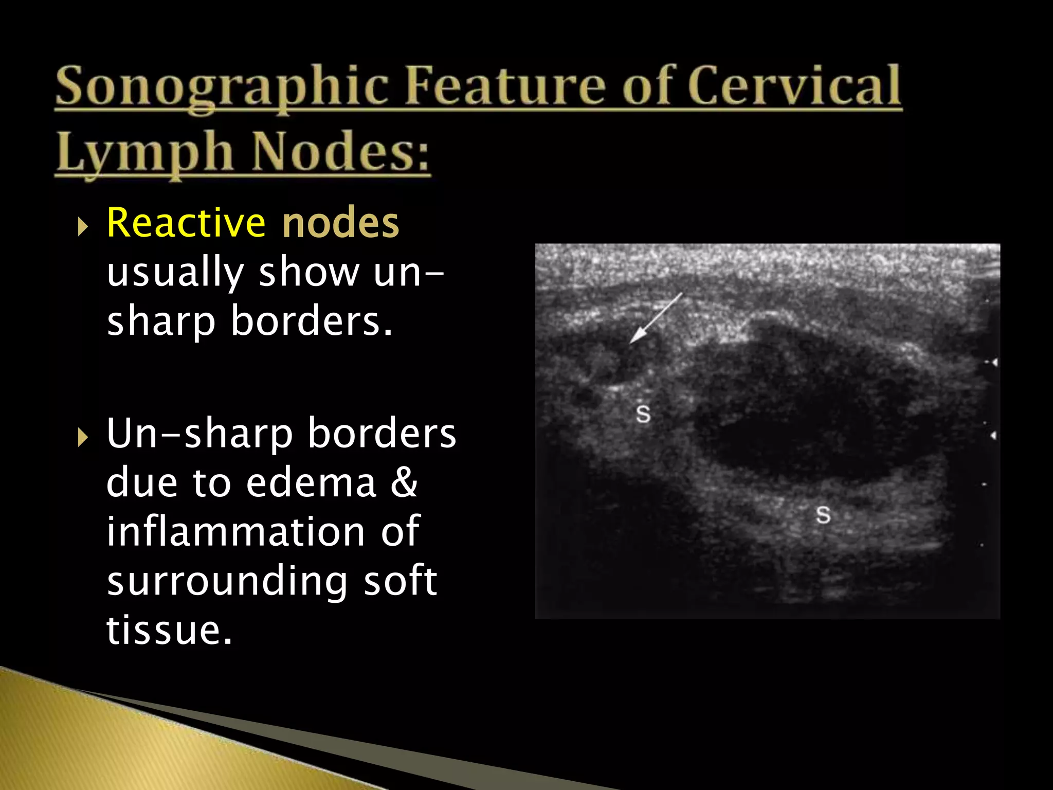 Imaging of cervical lymph nodes | PPTX