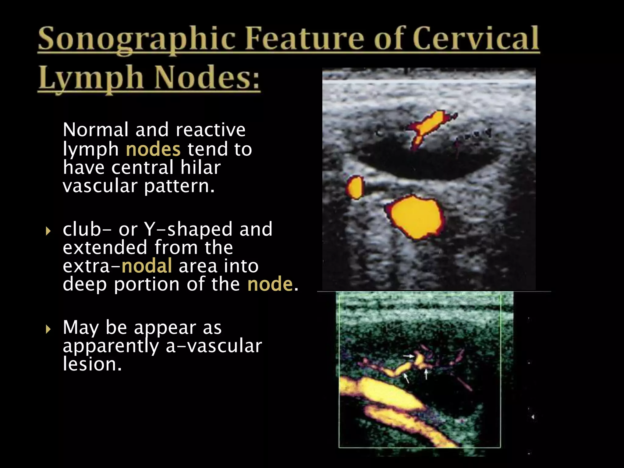 Imaging of cervical lymph nodes | PPTX