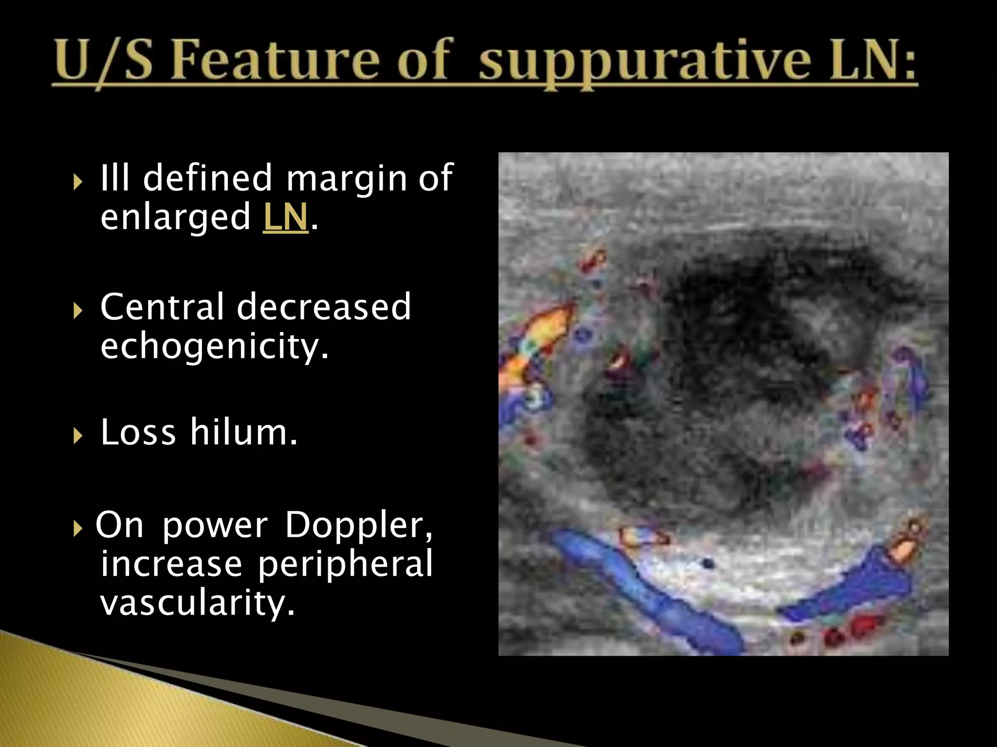 Imaging of cervical lymph nodes | PPTX