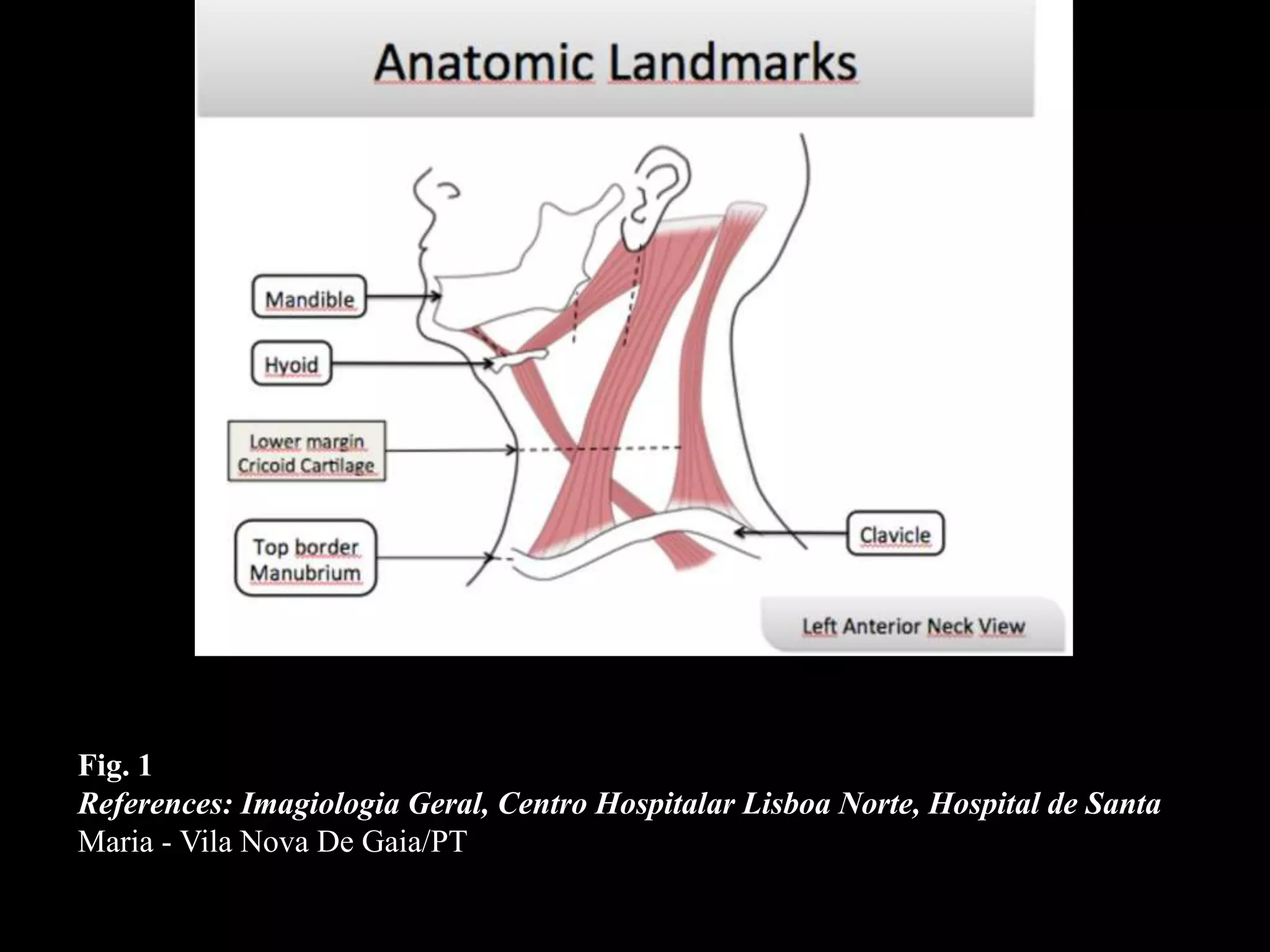 Imaging of cervical lymph nodes | PPTX