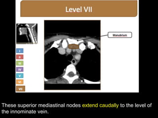 Imaging of cervical lymph nodes | PPTX
