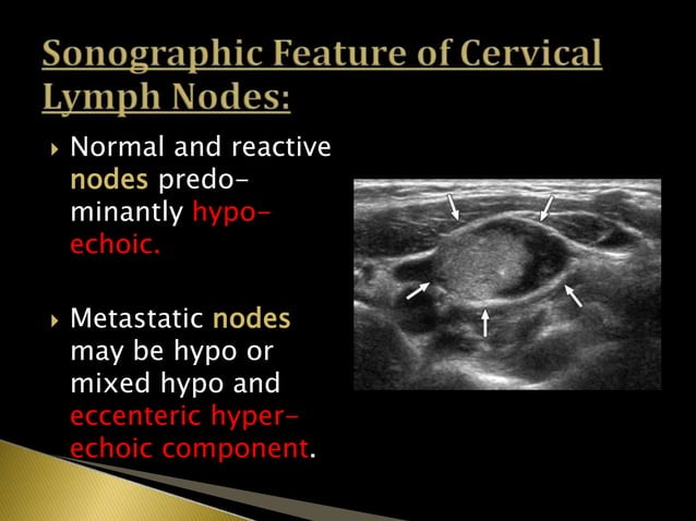 Imaging of cervical lymph nodes | PPTX