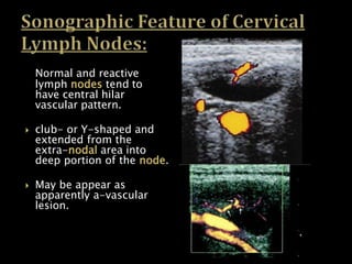 Imaging of cervical lymph nodes | PPTX