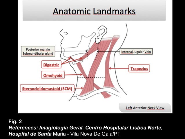 Imaging of cervical lymph nodes | PPTX