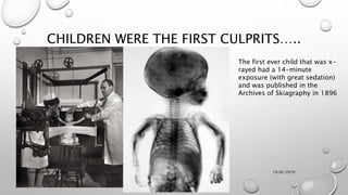 Imaging of children why they are different | PPTX