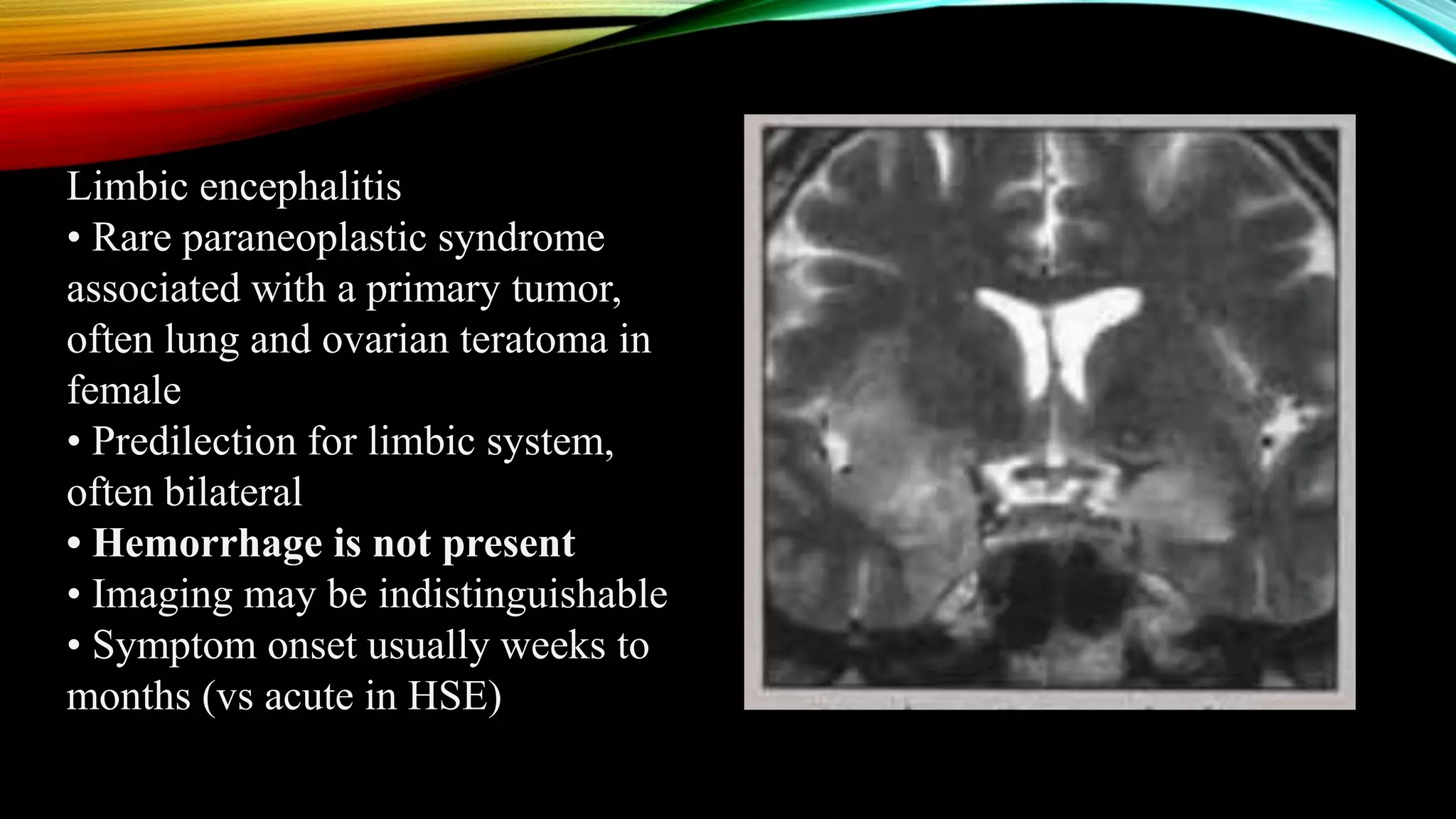 Imaging of common viral brain infection in india PPT | PPT