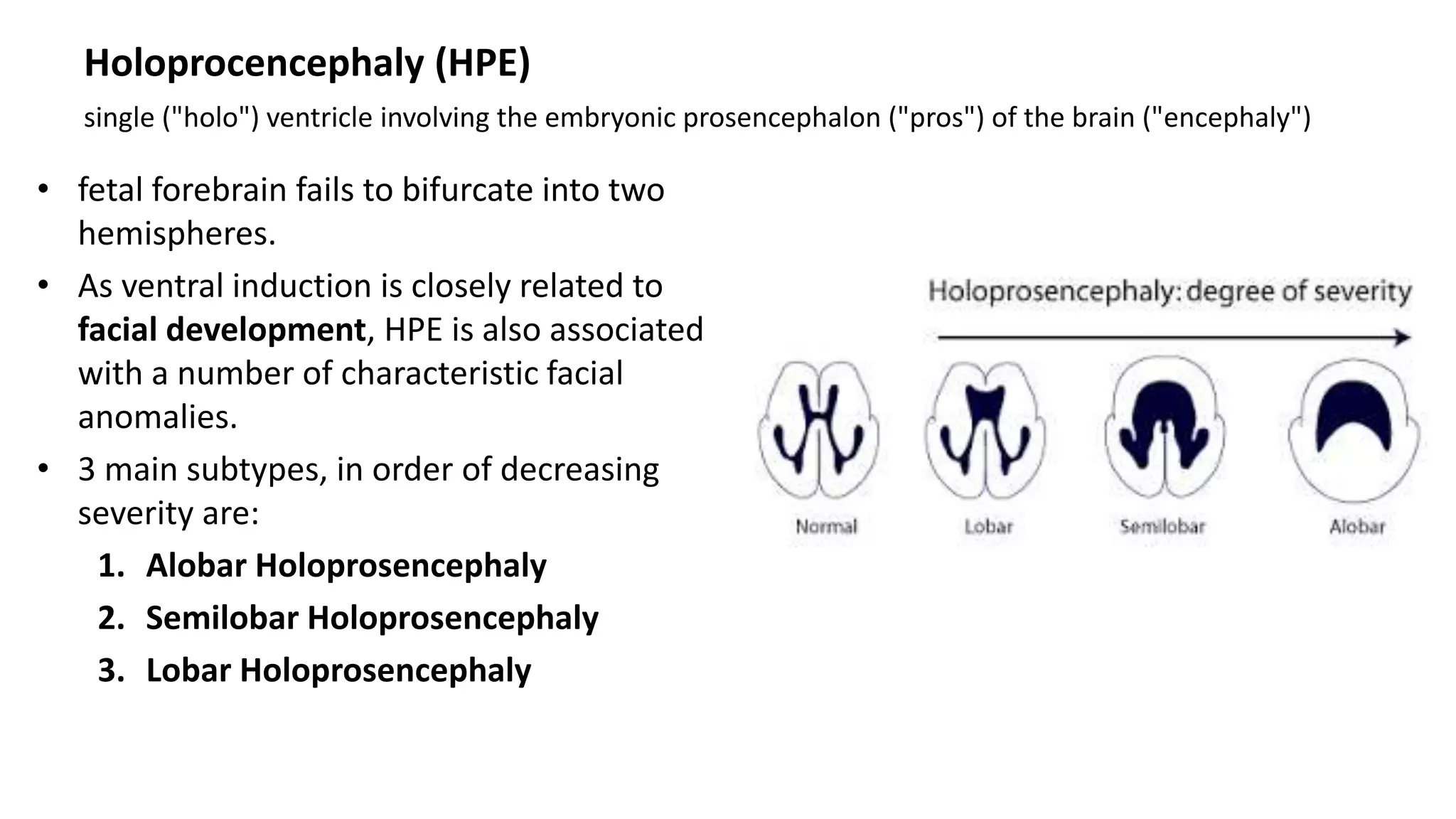 Imaging of congenital cns lesions | PPTX