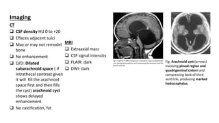 Imaging of congenital cns lesions | PPTX
