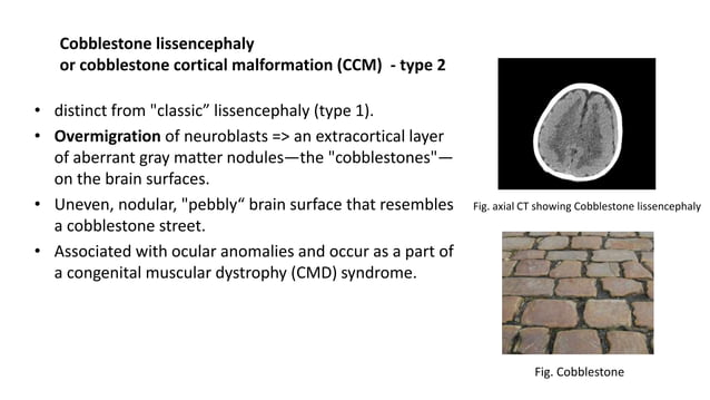 Imaging of congenital cns lesions | PPTX