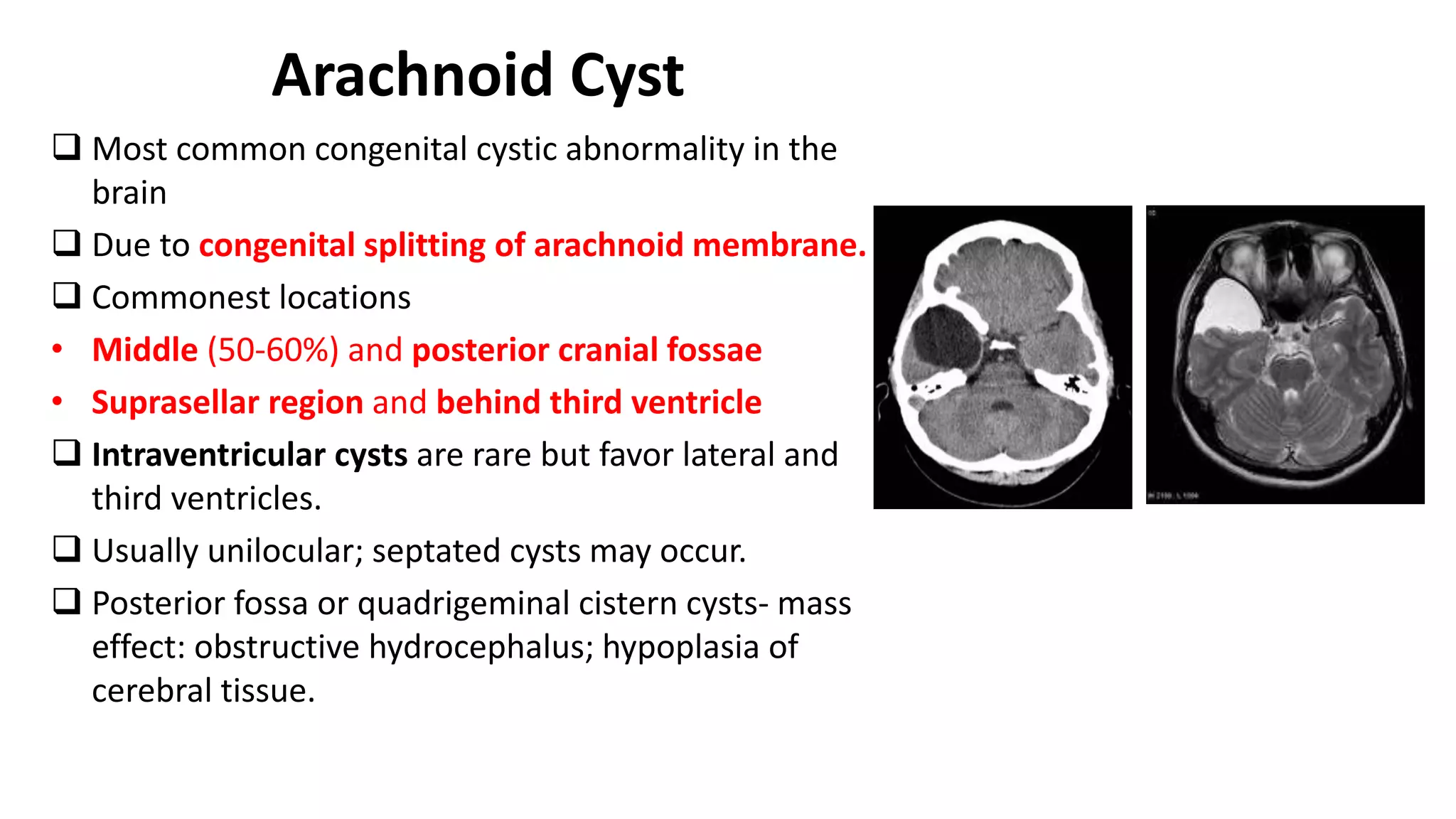 Imaging of congenital CNS lesions | PPTX
