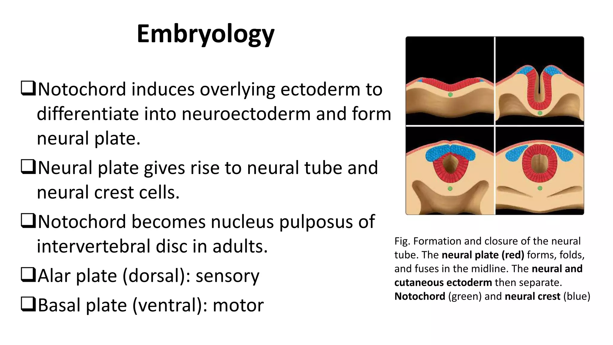 Imaging of congenital CNS lesions | PPT