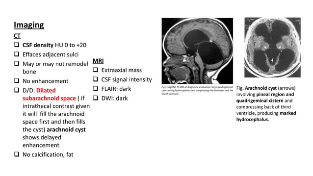 Imaging of congenital CNS lesions | PPTX